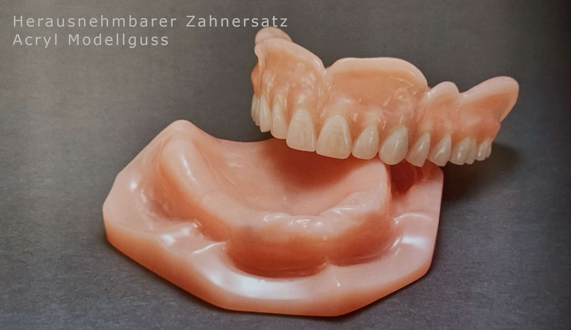 Acryl Modellguss Prothese - ViviDenti Zahnersatz