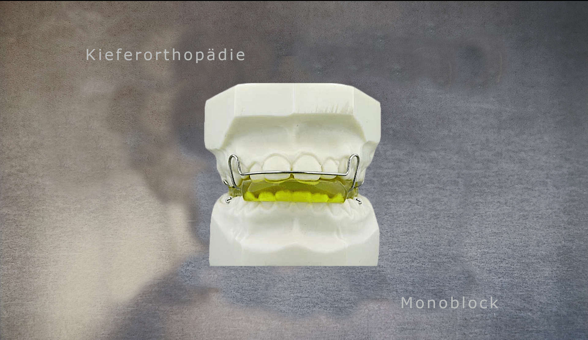 Monoblock - ViviDenti Zahnersatz