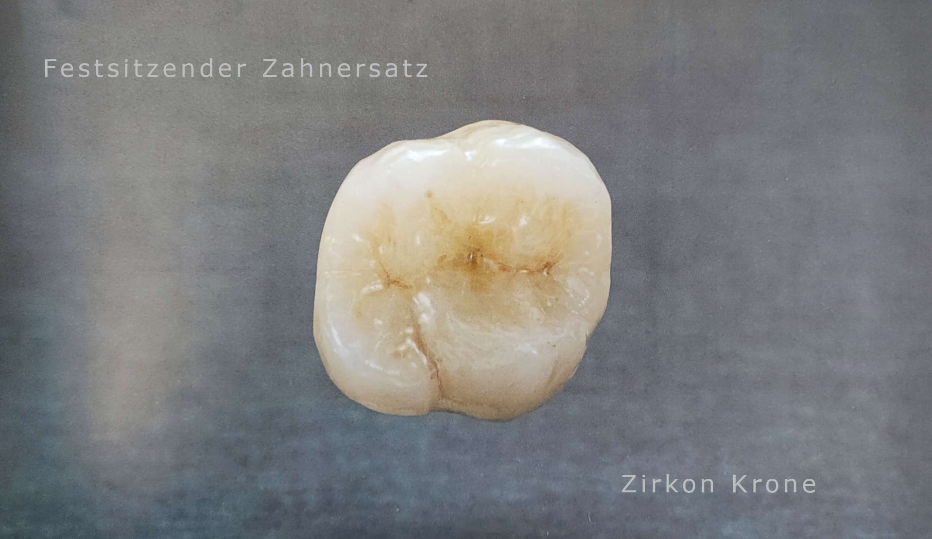 Produkte - ViviDenti Zahnersatz