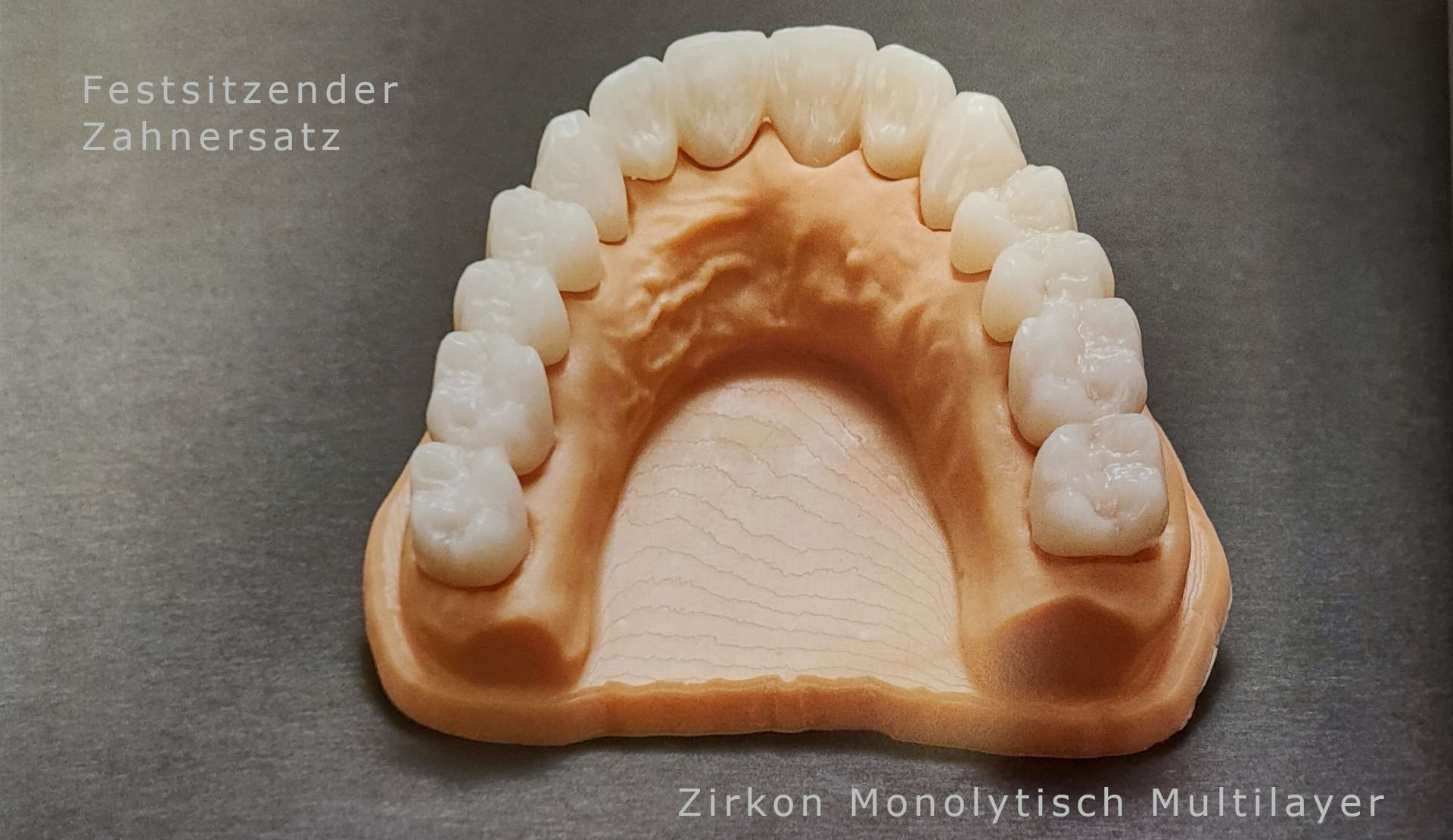 Produkte - ViviDenti Zahnersatz